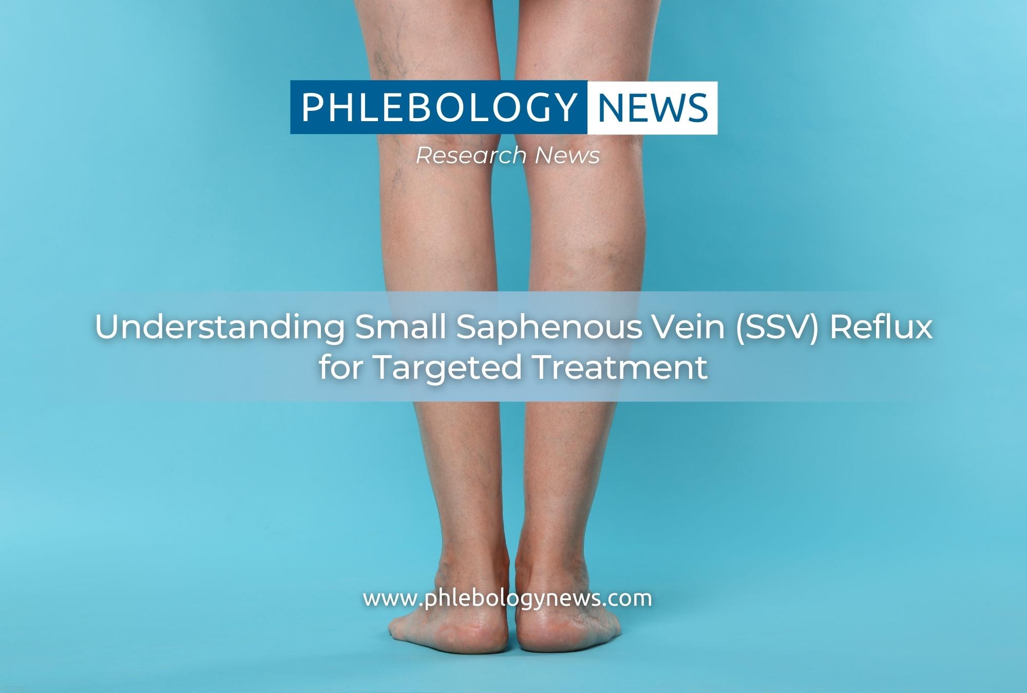 Understanding Small Saphenous Vein (SSV) Reflux for Targeted Treatment ...