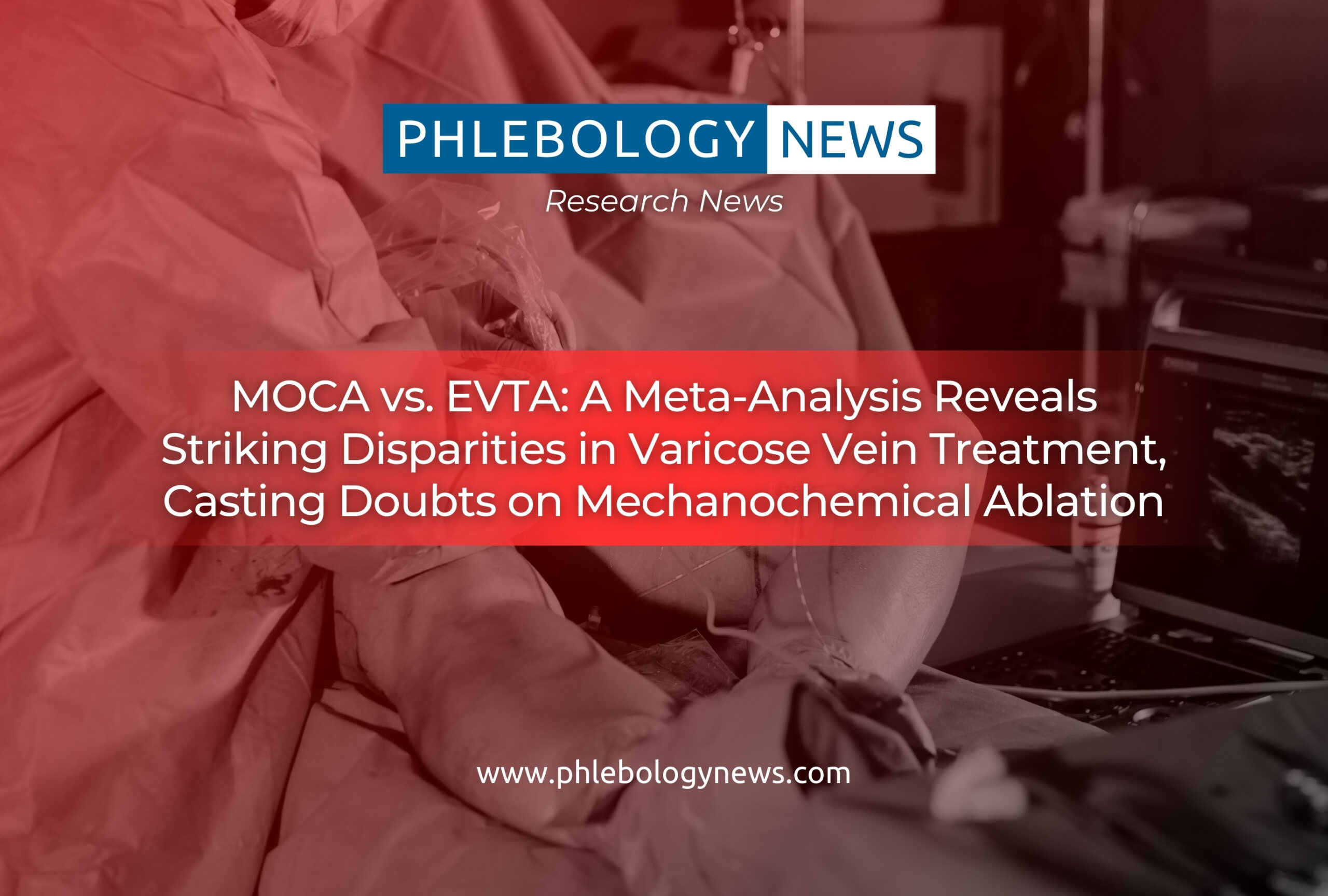 MOCA vs. EVTA: A Meta-Analysis Reveals Striking Disparities in Varicose ...